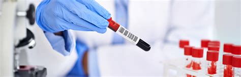 Lead Abatement Resource Center Hematological Effects