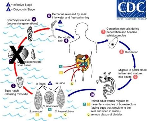 Sex Schistosomiasis Std Std Schistosomiasis