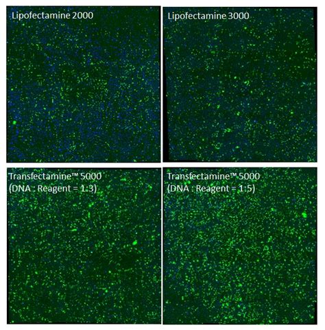 Transfectamine™ 5000 Transfection Reagent Aat Bioquest