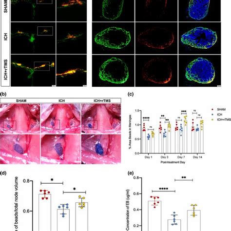 Design Of The Experiment A Rtms Treatment Was Started 3 Days After Download Scientific