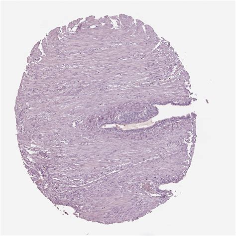 Tissue Expression Of Pdcd1 Staining In Prostate The Human Protein Atlas