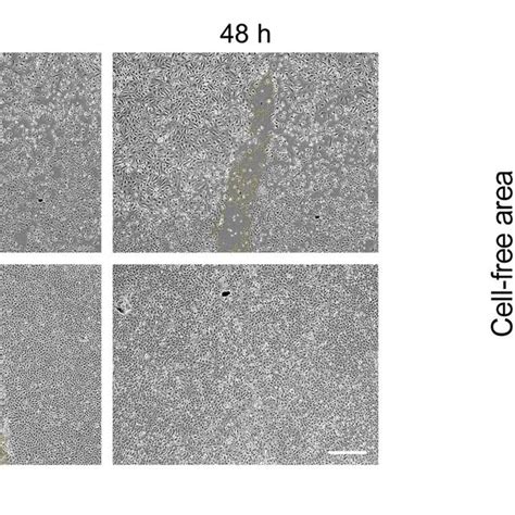 Assessment Of Cell Motility By Scratch Assay In The Wild Type Wt And Download Scientific
