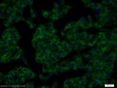 Rtn4 Nogo Antibody 10950 1 Ap Proteintech