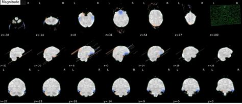 Epi Reference In Fmriprep Visual Report Error Software Support