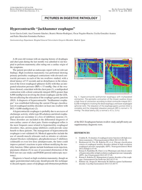 Pdf Hypercontractile Jackhammer Esophagus