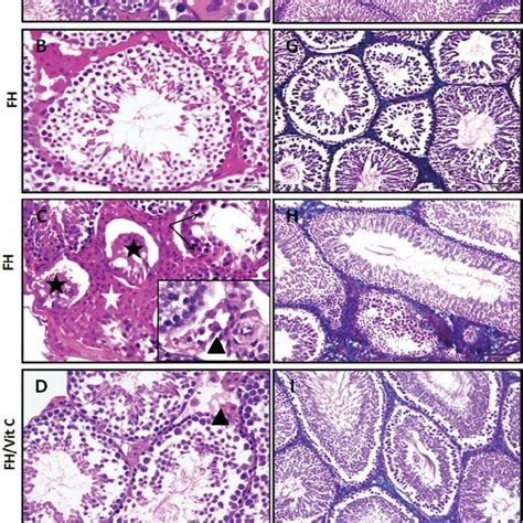 Epididymal Caput A Corpus B And Cauda C Of The Control Groups Download Scientific