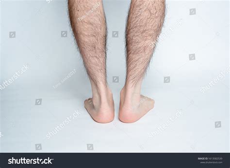 Legs Hair Removal Men Before Stock Photo Shutterstock