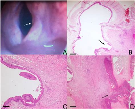 Development Of An Animal Model For Type Ii Sulcus Sulcus Vergeture