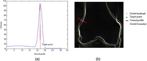 robust x ray image segmentation by spectral clustering and active shape