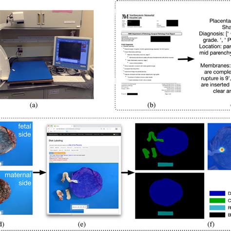 Data Curation Process A Placenta Photography Equipment At