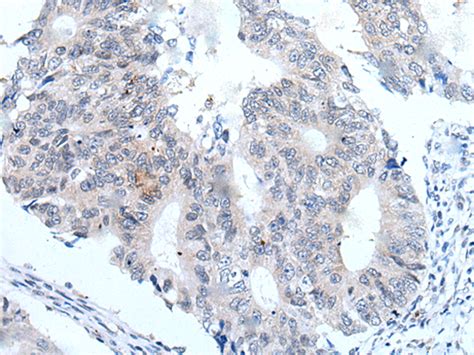 兔抗ulk1多克隆抗体anti Ulk1 Rabbit Polyclonal Antibody 生命科学产品与技术服务 生工生物工程上海