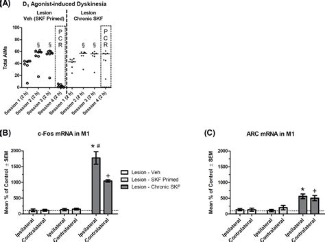 Alterations In Primary Motor Cortex Neurotransmission And Gene Expression In Hemi Parkinsonian