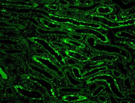 Indirect Immunofluorescence Detection Bio Sb