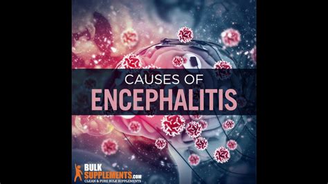 What Is Encephalitis What Causes Encephalitis How Do You Get