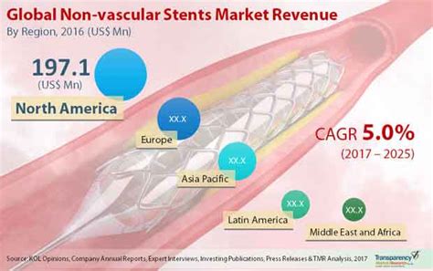 Non Vascular Stents Market To Reach Of Us 730 5 Million By 2025 Tmr