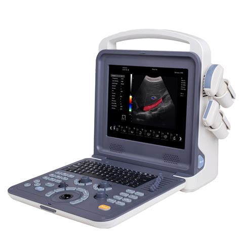 Laptop Digital Ultrasound Scanner Color Doppler Ultrasound System Hot