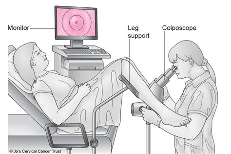 Coding For Colposcopy Ob Gyn Cpt Codes And Modifiers For 2025 Eoys