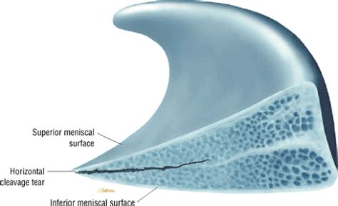 The Knee Musculoskeletal Key