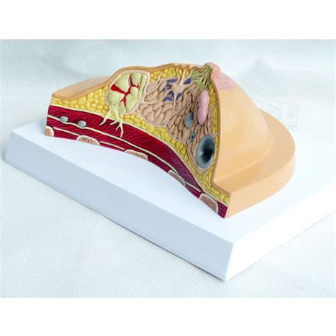 Buy Female Profile Structure Anatomical Modelanatomy Disease Cancer