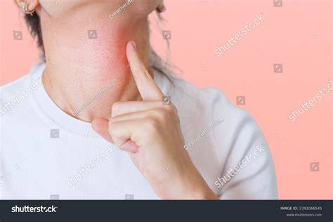 299 Tonsil Tumor 图片、库存照片、3d 物体和矢量图 Shutterstock