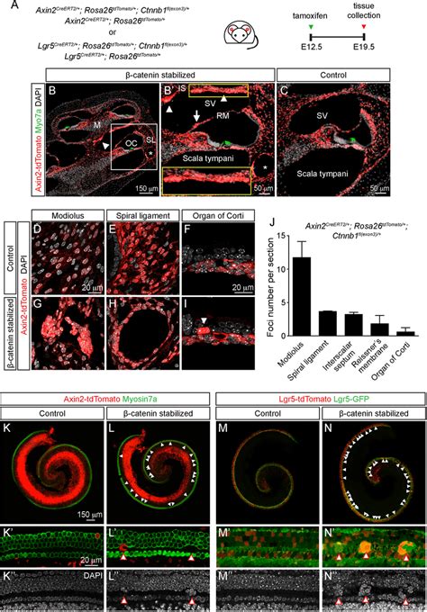 Formation Of Foci In The Cochlear Duct And Periotic Mesenchyme After