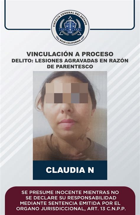 Vinculan A Proceso A Mujer Investigada Por Lesiones Agravadas En Razón