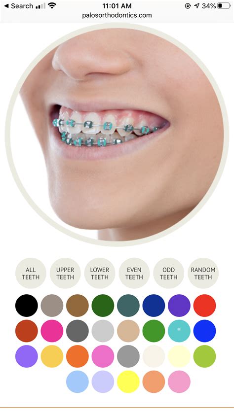 Teal Braces For Teeth
