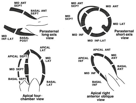 Cardiac Wall Segments Medical Ultrasound Cardiac Sonography