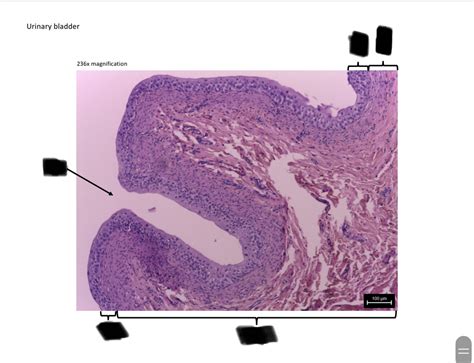 Urinary Bladder Slide Diagram Quizlet