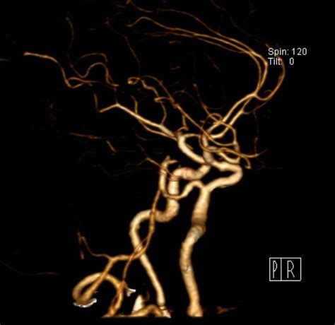 The Ultimate Radiology Quiz Trivia Quiz Flashcards And Trivia