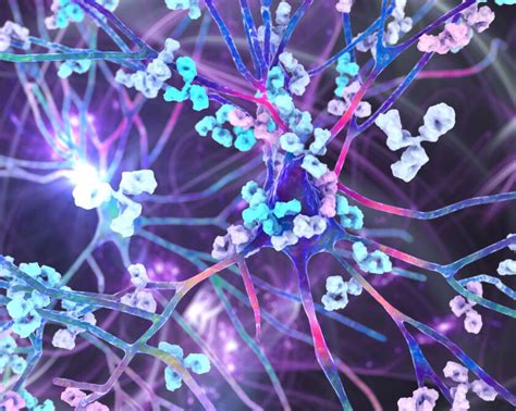 Autoimmune Thyroiditis Hashimotos Thyroiditis Usz