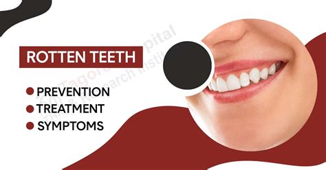 Rotten Teeth Causes Symptoms Prevention And Treatment