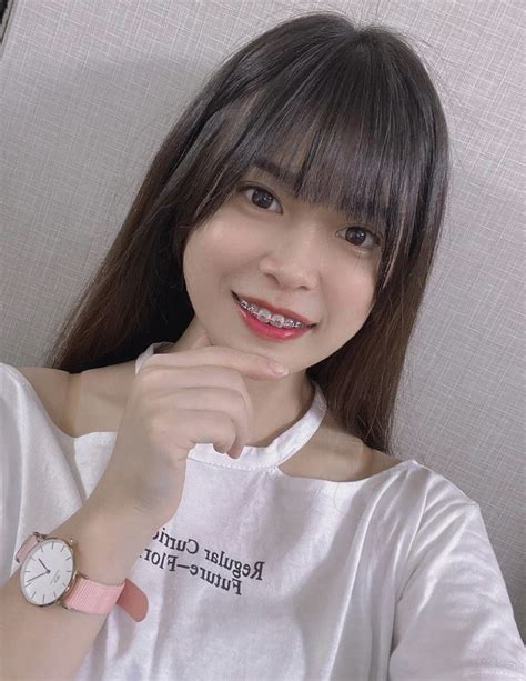 「เหล็กดัดฟัน」おしゃれまとめの人気アイデア｜pinterest｜kittikan Kansup【2024】 歯科 矯正歯科