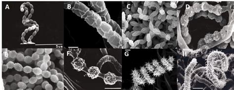 Morphological Identification Of Actinobacteria Intechopen