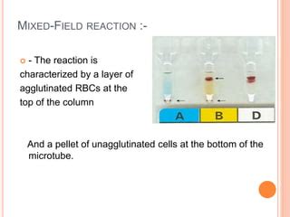 Gel Card Technology Ppt Nc Pptx