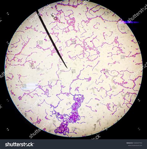 Gram Positive Streptococci