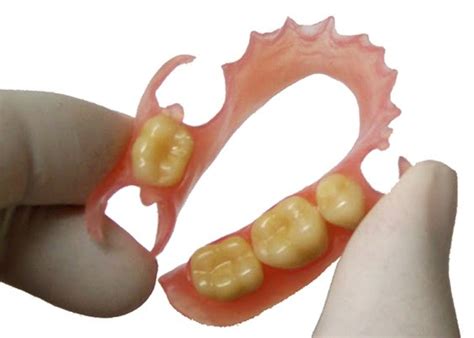 Prótesis Flexible Clínica Dental Dr M López De Calatayud