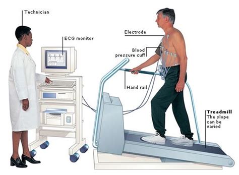 Exercise Stress Test Treadmill