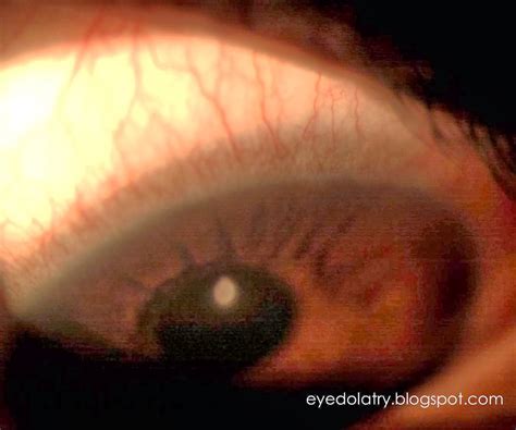 External Photography Bonanza Eyedolatry