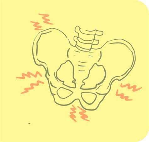 Understanding Pelvic Organ Prolapse And Incontinence Phrc