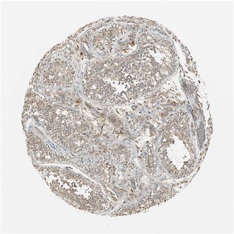 Tissue Expression Of Keap1 Staining In Testis The Human Protein Atlas