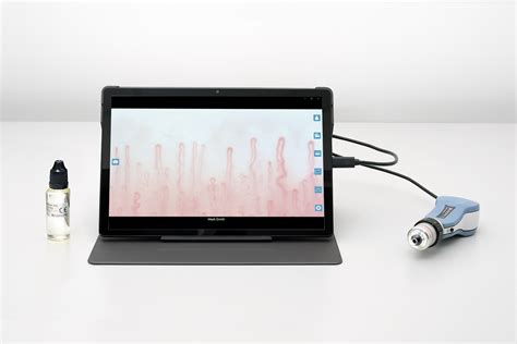 Capiscope Range Capillaroscopy