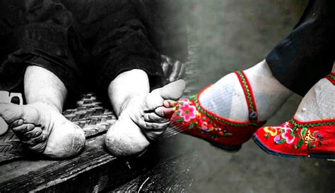 Pie De Loto ¿por Qué Las Mujeres En China Se Vendaban Los Pies Para