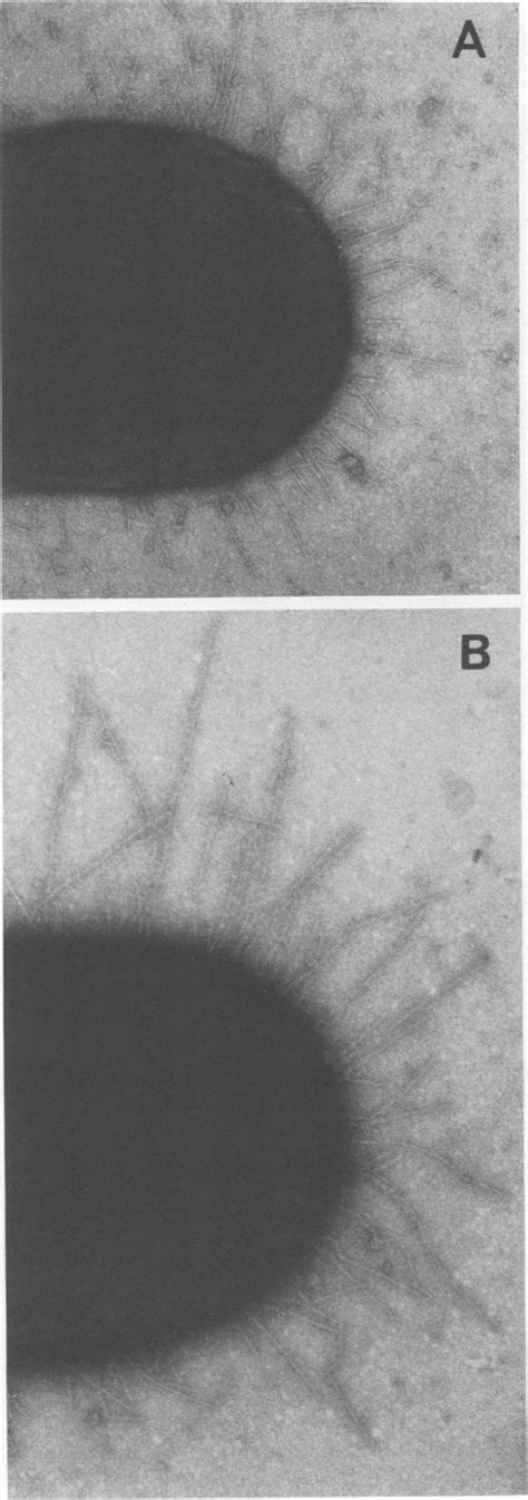 Electron Micrographs Of Streptomycin Re Tive To Some Of The Download Scientific Diagram