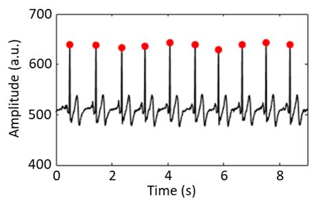 什么是心率和心率变异性？如何分析？ Hrv 心率 变异性 分析 数据 间隔 心跳 设备 健康界