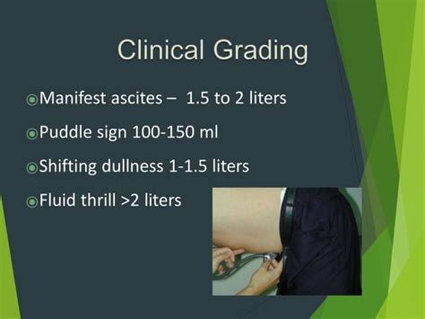 Ascites Medical Presentation In Surgerypptx