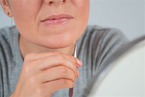 Hirsutism Pcos Treatment