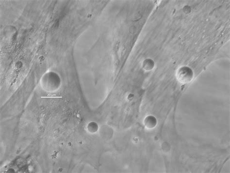 What Could Be These Spherical Structures Among Cells Researchgate