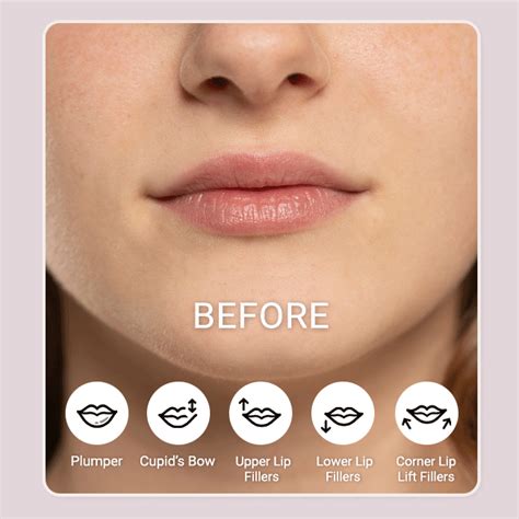 How Filler Simulator Benefit Clinics And Clients