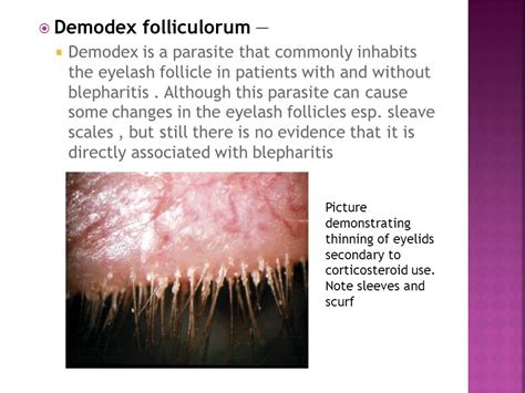 Parasitic Blepharitis